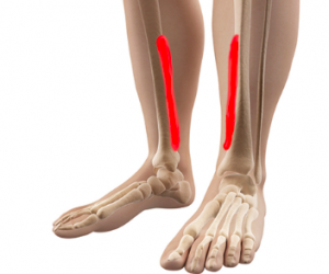 La Périostite - Clinique Performance Santé - Clinique Performance Santé