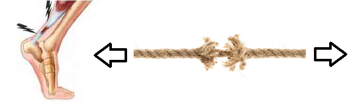 Tendinopathies Chroniques - Clinique Performance Santé - Clinique ...